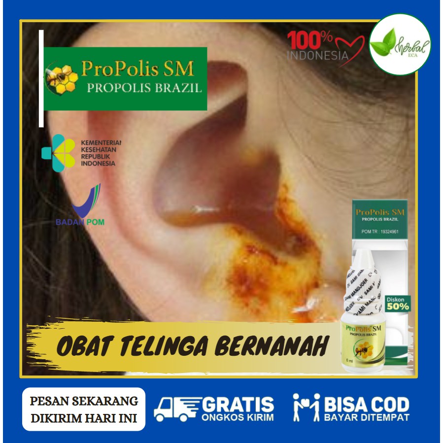 Jual Obat Otitis Media / Telinga Bernanah Akibat Infeksi Telinga Bagian ...