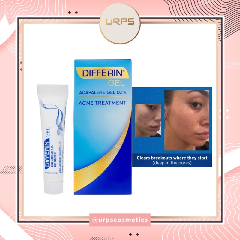 Jual Differin Adapalene Gel 0.1% Acne Treatment 15g | Shopee Indonesia