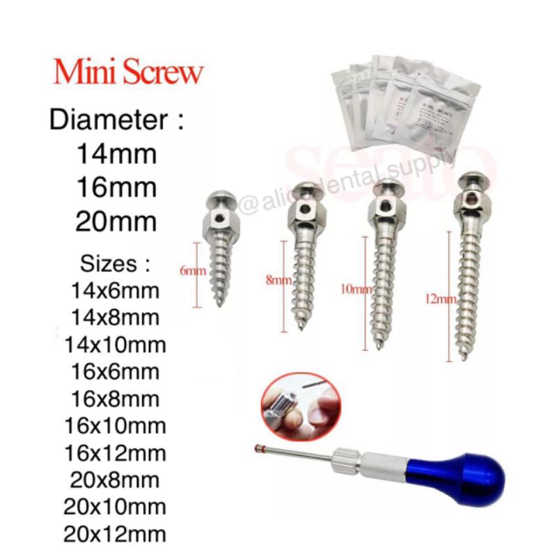 Jual Alice dental mini screw implan implant orthodontic screw ortho ...