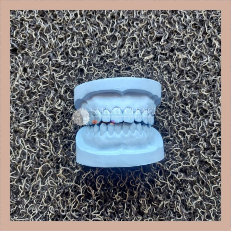 Jual Dental Model Study gips / model gigi gips / model study gipsum ...