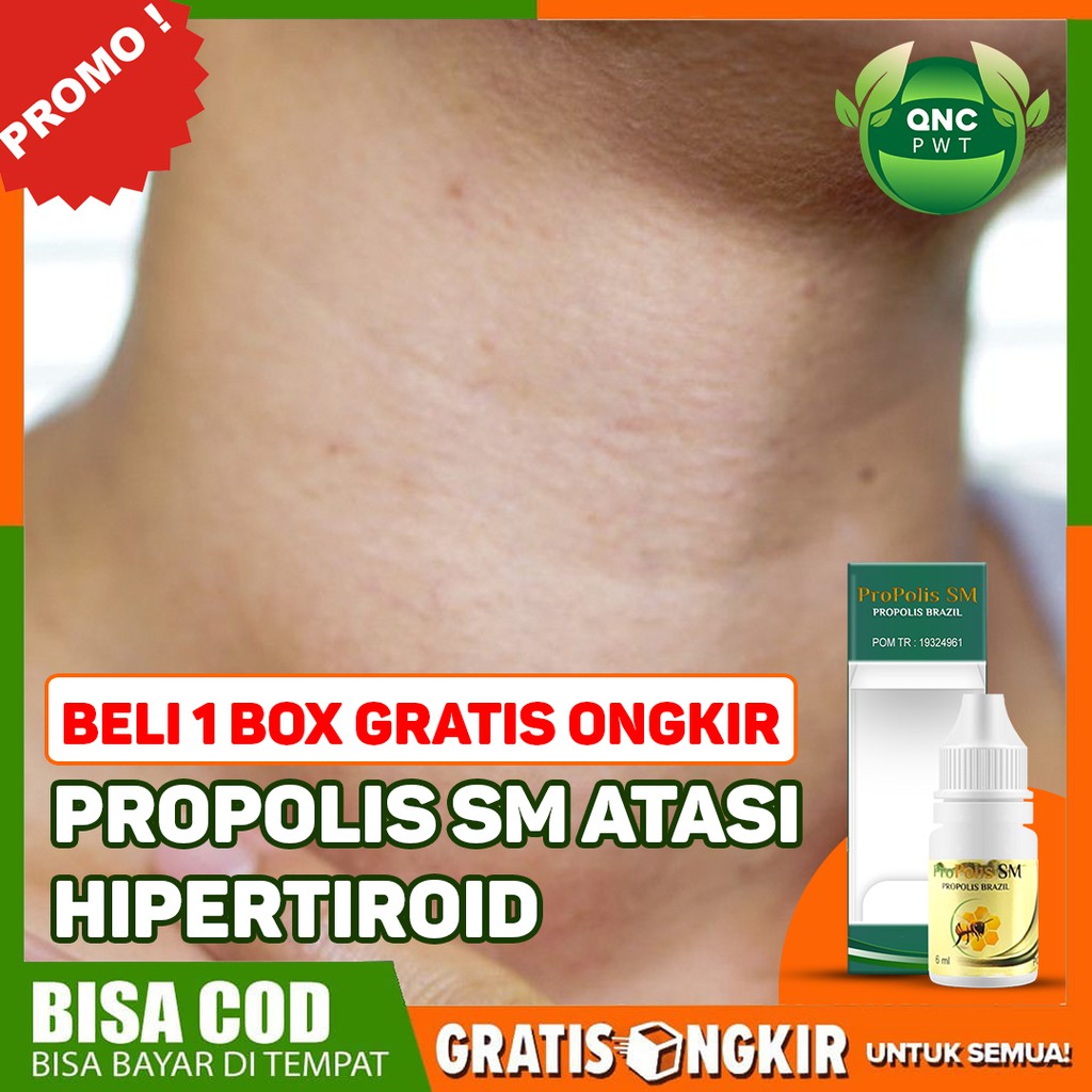Jual Obat Hipertiroid, Tiroid Membengkak, Kelenjar Tiroid, Tiroid Leher ...