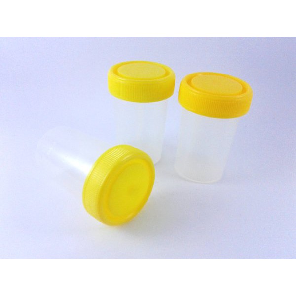 Jual Urine Pot Plastik Onemed Vol. 60 ml / 60 cc | Shopee Indonesia