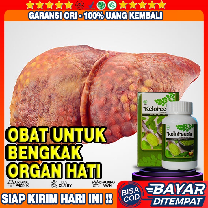 Jual Obat Pembengkakan Organ Hati - Obat Radang Liver - Obat Penyakit ...