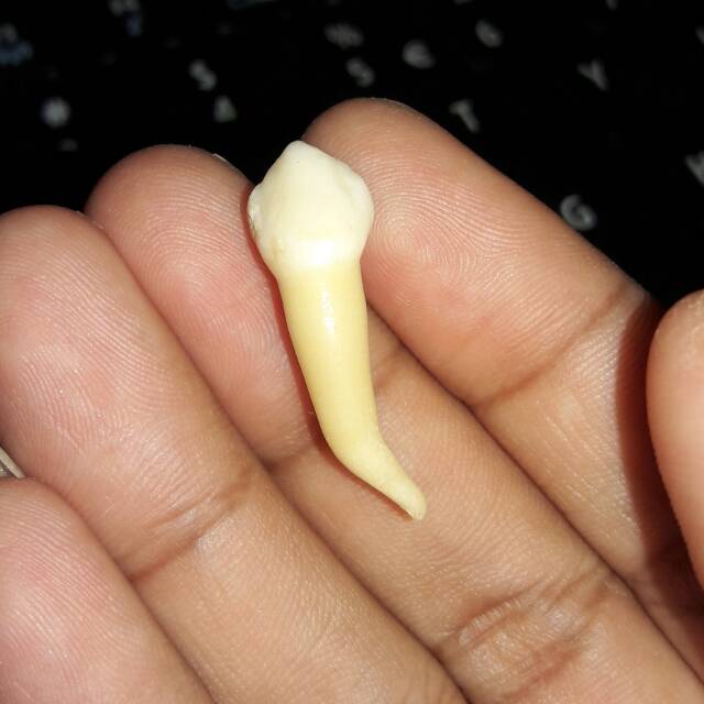 Jual Jual gigi permanen asli (caninus atas) | Shopee Indonesia