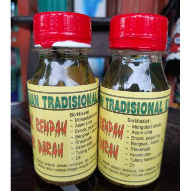 Jual Minyak rempah akar darah 100 ml | Shopee Indonesia