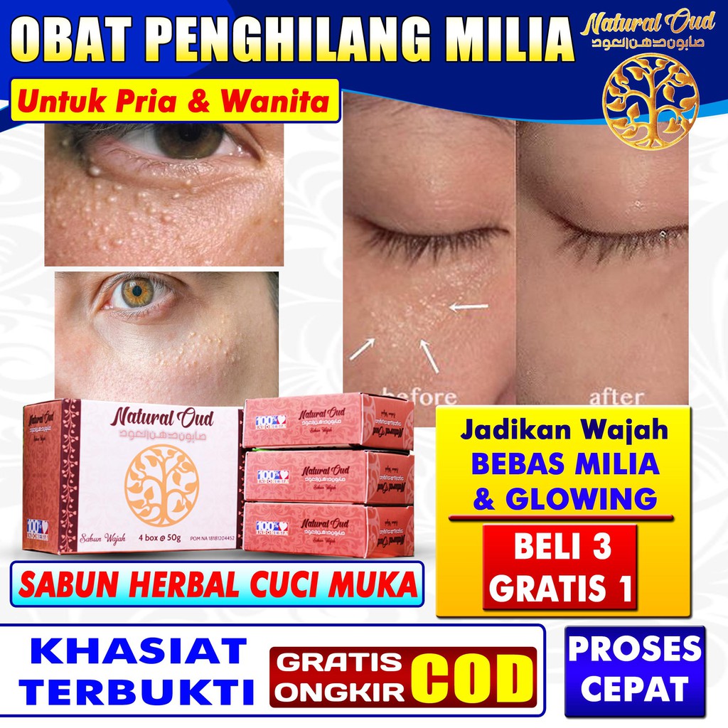 Jual Obat Milia Di Wajah, Kelopak Mata, Pipi, Hidung, Dahi, Bawah Mata ...