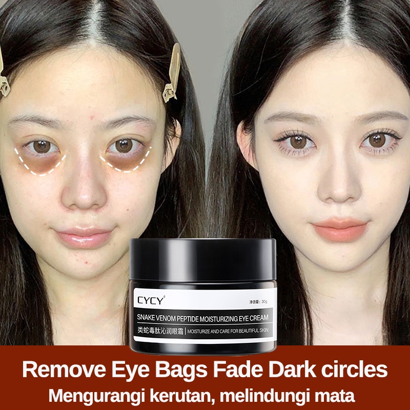 Jual Eye cream Krim mata Cream mata panda Krim mata panda Dark circle ...