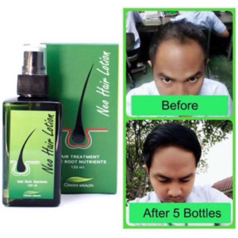 Jual NEO HAIR LOTION SERUM by Green Wealth ANTI RONTOK DAN PENUMBUH ...