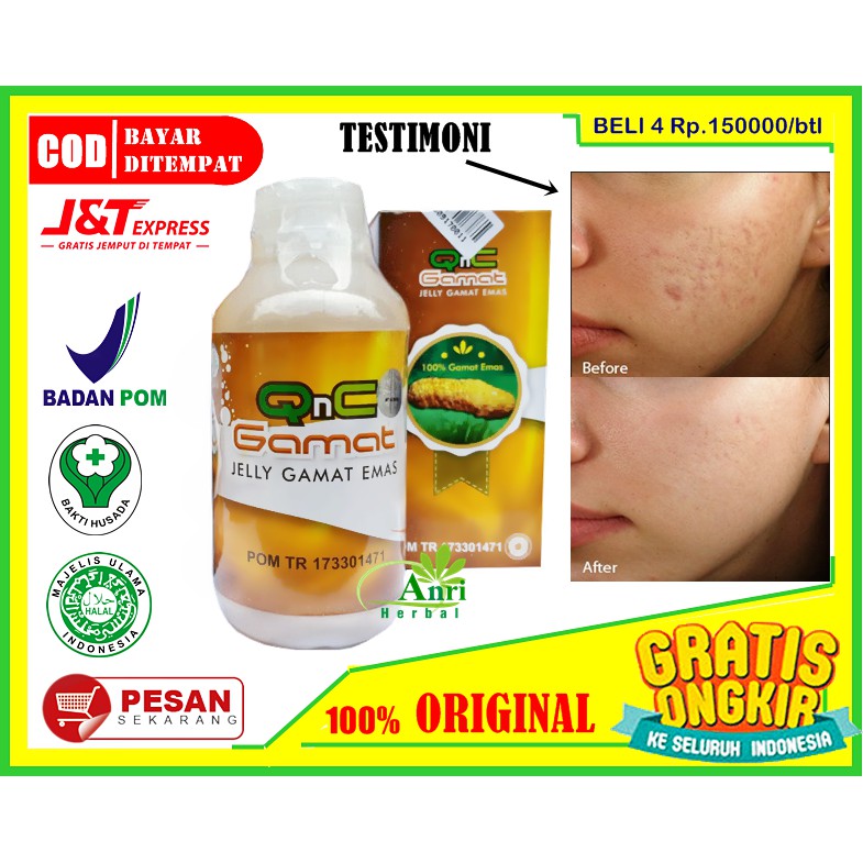 Jual Obat Penghilang Bopeng, Keloid, Vitiligo, Bercak Putih, Bekas luka ...