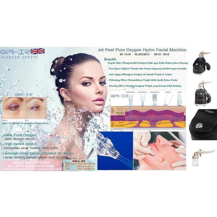 Jual OPHIR JET PEEL PURE OXYGEN 98% HYDRA FACIAL MADE IN UK | Shopee ...