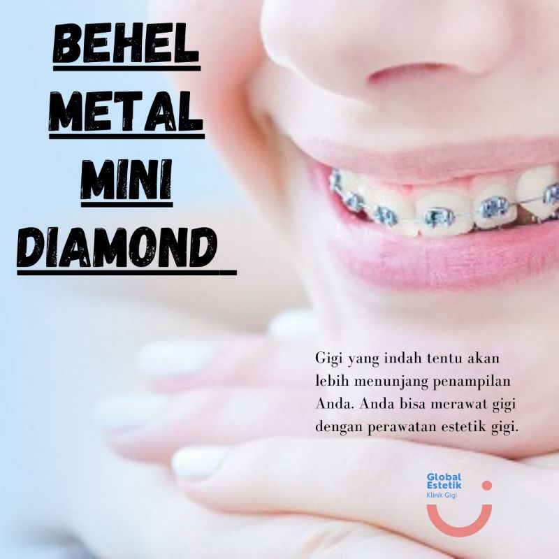 Jual BehelMetalMini DIAMOND | Shopee Indonesia