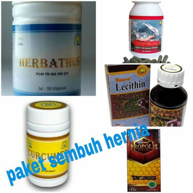 Jual Paket Obat Herbal Hernia Nasa Murah | Shopee Indonesia