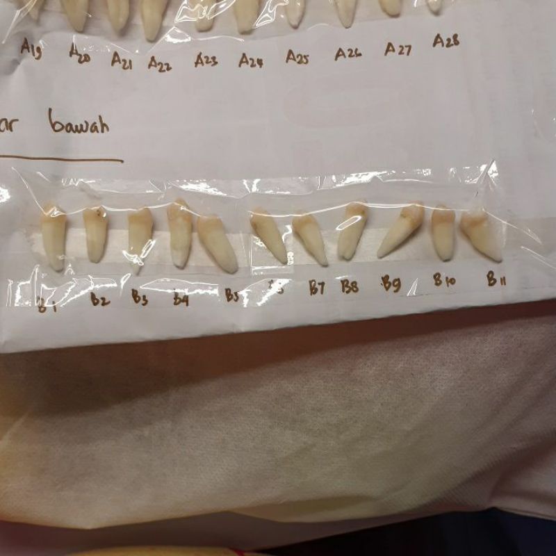 Jual gigi praktikum kedokteran gigi insisivus, caninus, premolar, molar ...