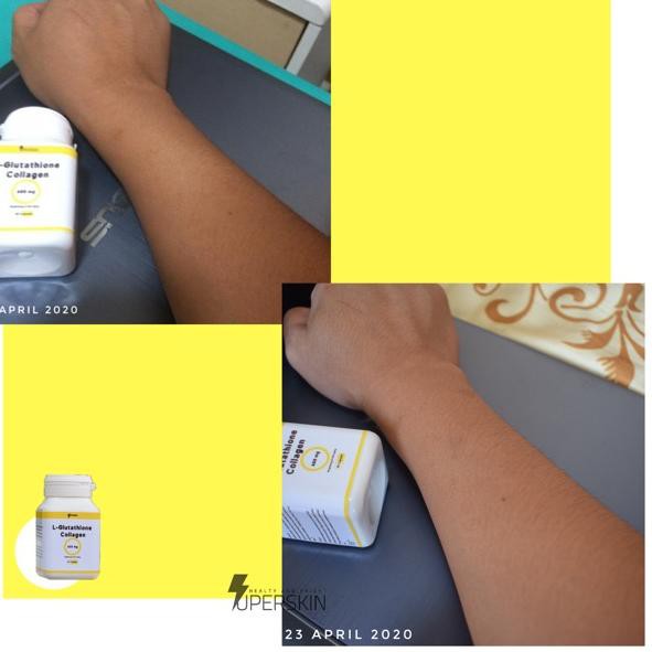 Jual Terbaru 9GI0P 600MG GLUTATHION + COLLAGEN L-GLUTATHIONE WHITENING ...
