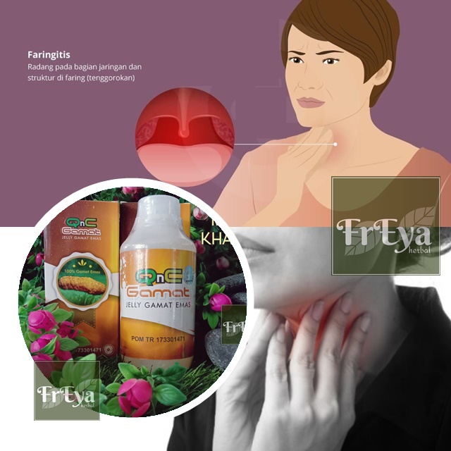 Jual OBAT FARINGITIS, OBAT RADANG TENGGOROKAN, OBAT SAKIT TENGGOROKAN ...