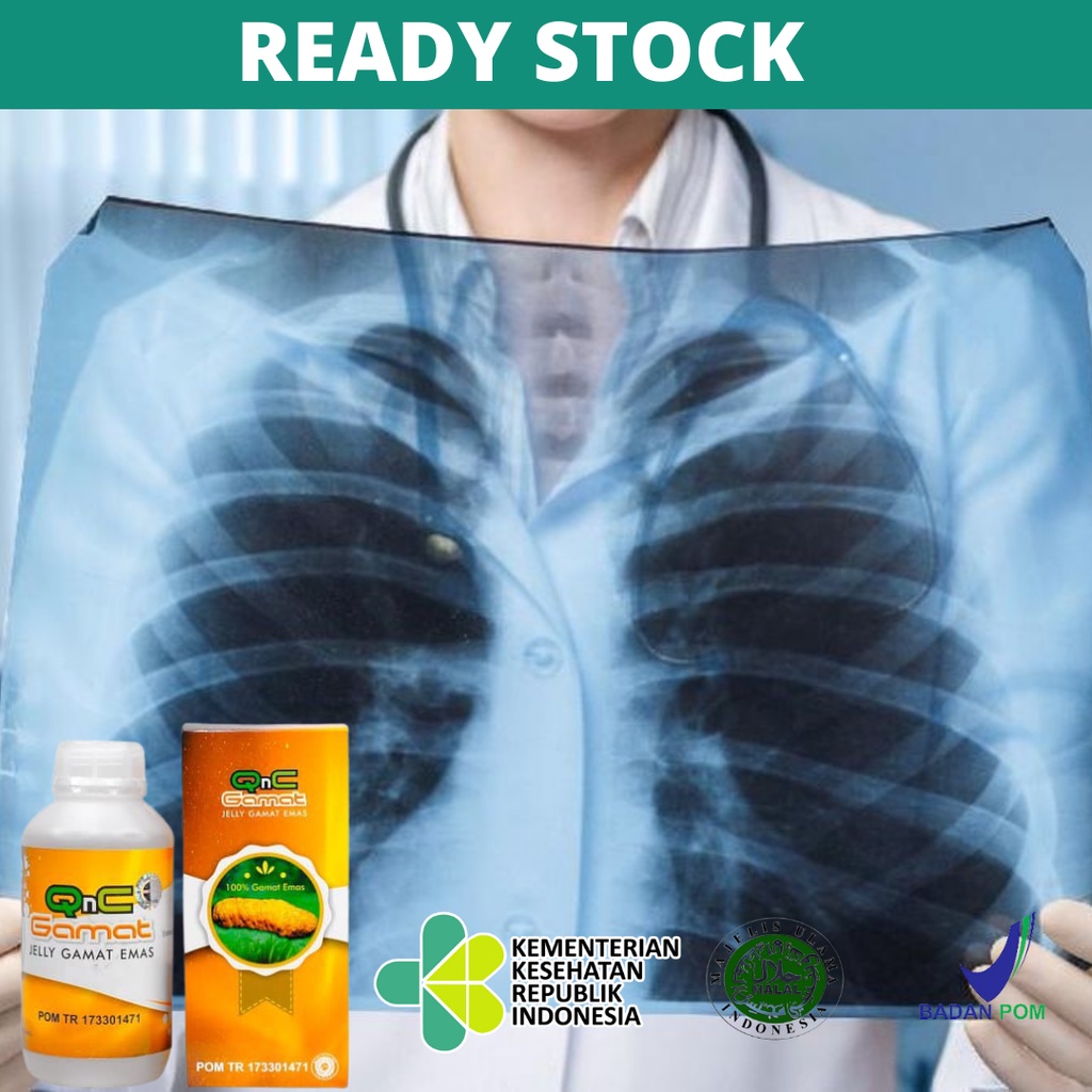 Jual Obat Herbal Flek Paru Paru, Obat Gurah Lendir Paru Paru, Pembersih ...