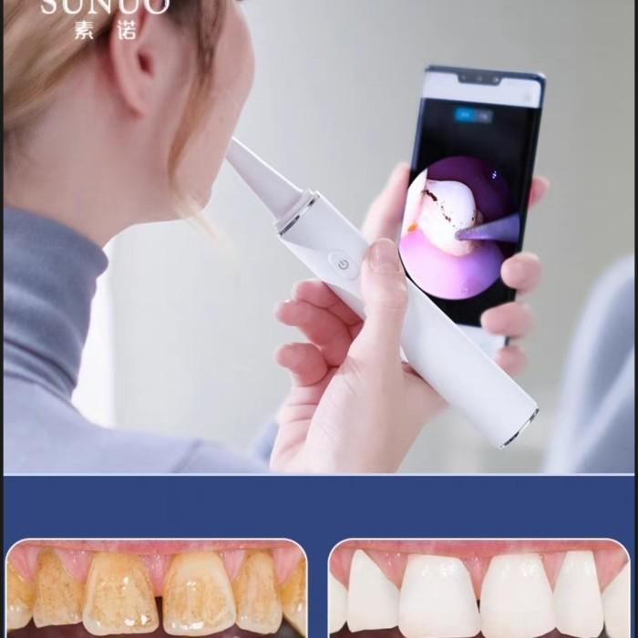 Jual Xiaomi Youpin SUNUO Smart Visual Electric Sonic Dental Scaler ...