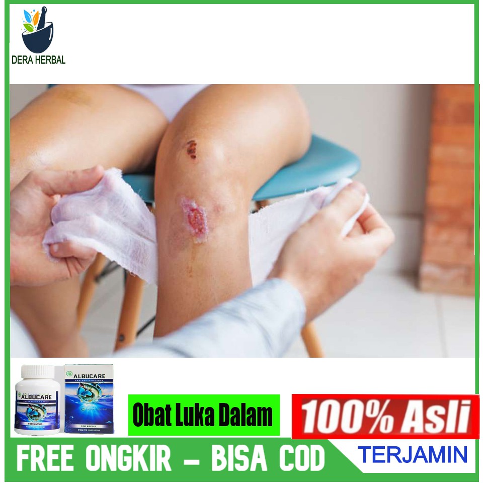 Jual Obat luka dalam, luka tusuk, luka sayatan Albucare Ekstrak Ikan ...