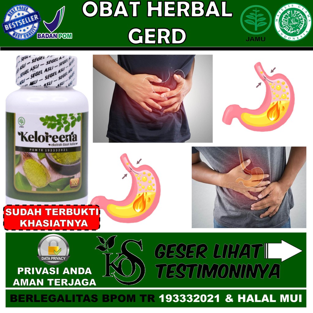 Jual Obat Gerd Alami Obat Asam Lambung Naik Ke Kerongkongan Obat Mules ...
