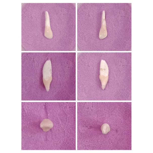 Jual Gigi Asli Praktikum Gigi 12 Gigi Insisif Lateral Rahang Atas Regio ...