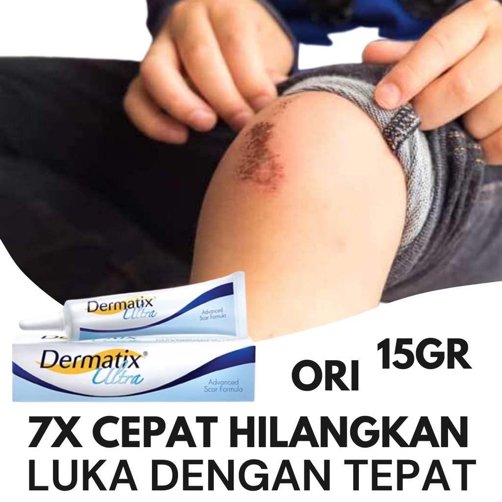 Jual Dermatix Ultra Gel Original 100% Salep Penghilang Bekas Luka Hitam Koreng Di Kaki Anak Obat ...