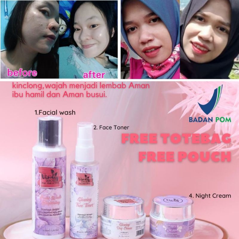Jual PAKET SUPER KINCLONG BPOM / VINDY SKINCARE ORIGINAL | Shopee Indonesia