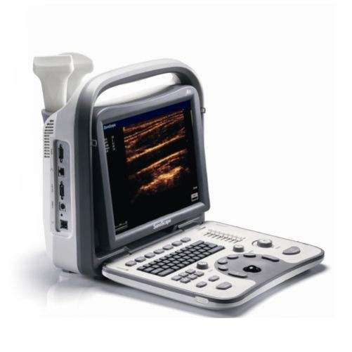 Jual Sonoscape USG 2D Portable A5 | Shopee Indonesia