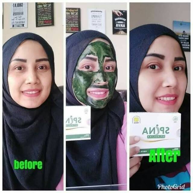 Jual SPIRA (KAPSUL SPIRULINA isi 20 KAPSUL) | Shopee Indonesia