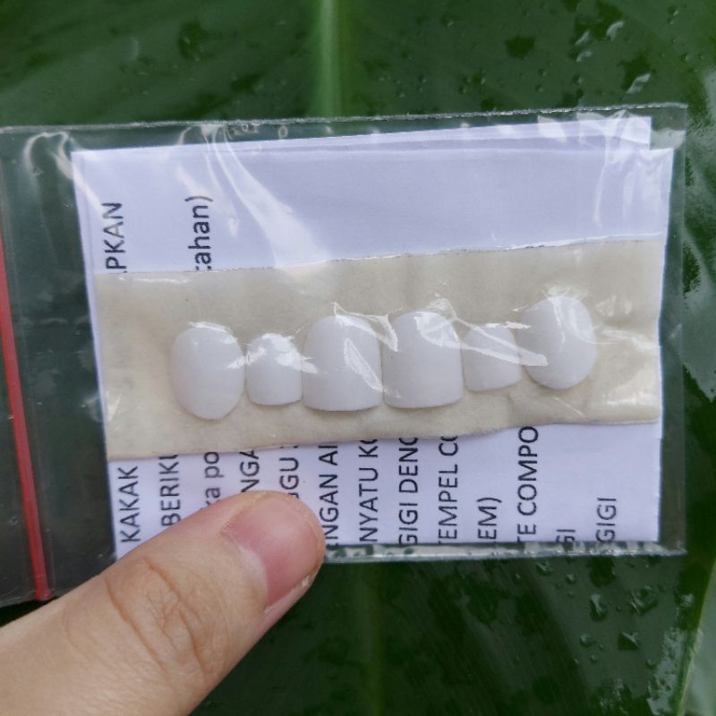 Jual VENEER bunny tooth non direct ukuran besar. tinggal tempel tak ...