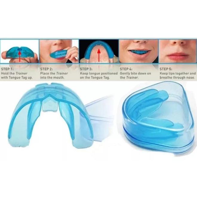 Jual /////] Behel Ajaib Retainer Gigi Perapi Gigi Dental USA / Dental ...