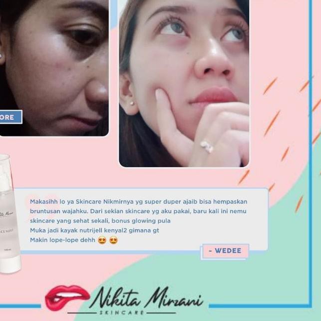 Jual Nikita Mirzani Skincare [] [FREE GIFT + FREE ONGKIR] 100% ORIGINAL ODDBSC | Shopee Indonesia