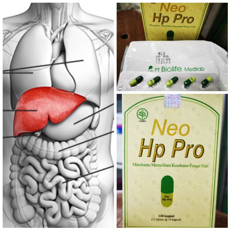 Jual Hp Pro obat dan vitamin Hepatitis | Shopee Indonesia
