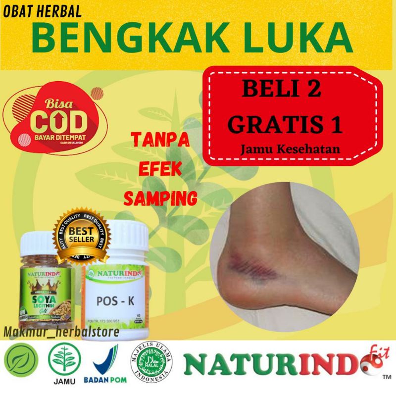 Jual Obat Herbal Bengkak , Bengkak Ginjal , Bengkak Jantung ,Bengkak ...