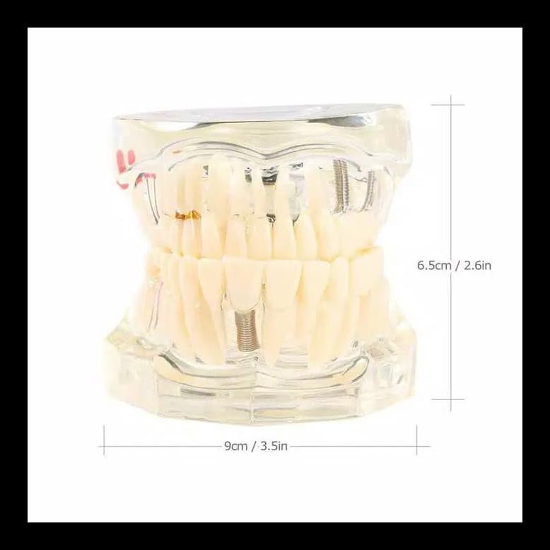 Jual UPDATE STUDY MODEL GIGI TRANSPARAN / PHANTOM GIGI LENGKAP BEHEL ...