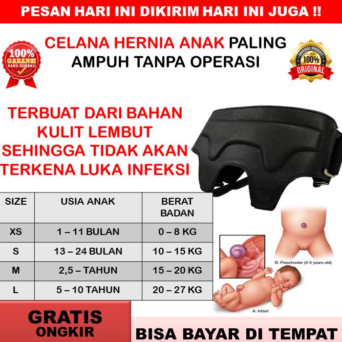 Jual Celana Hernia Anak,Celana Dalam Hernia Bayi Balita Dan Obat Hernia ...