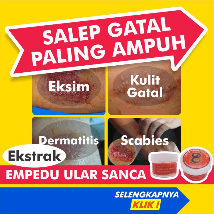Jual Salep Gatal Paling Ampuh Luka Diabetes Obat Gatel Selangkangan ...