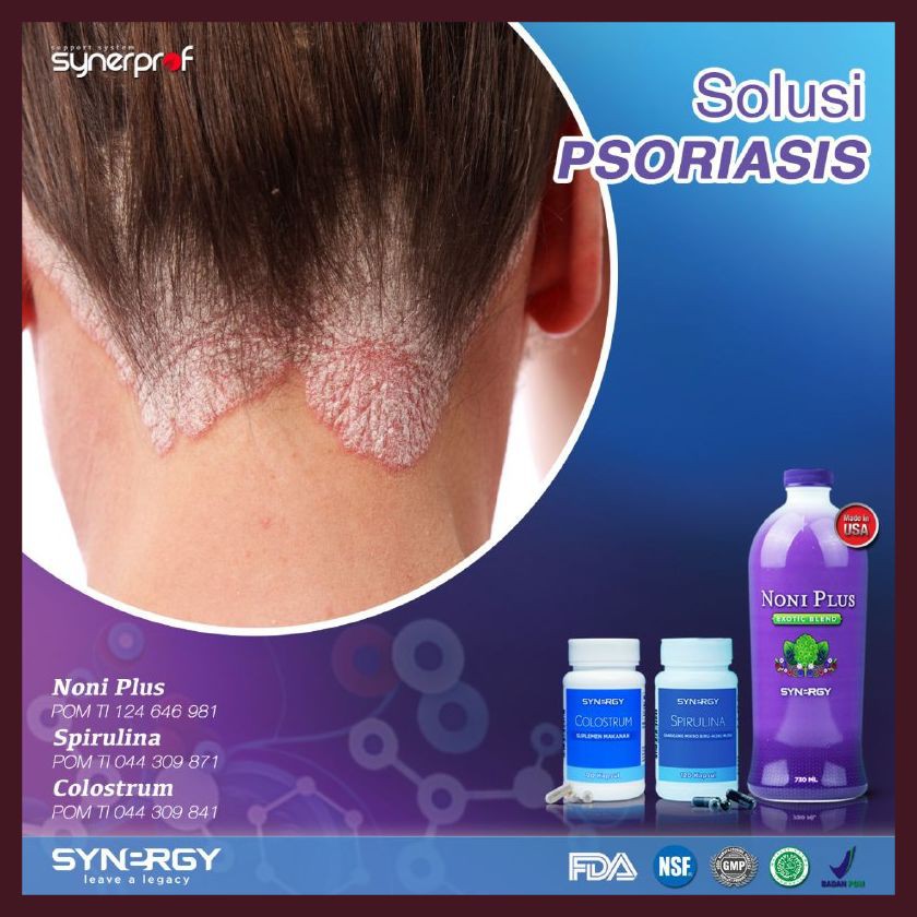 Jual Obat Psoriasis - Spirulina + Noni Plus + Colostrum | Shopee Indonesia