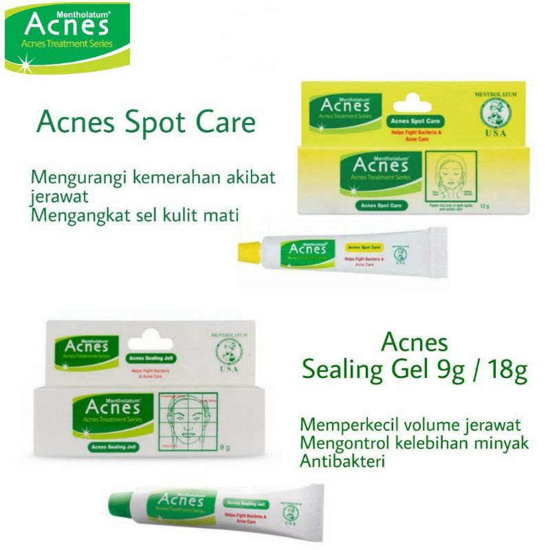 Jual Acnes sealing gel 9g/18g dan Acnes Spot Care 12g | Obat Totol ...