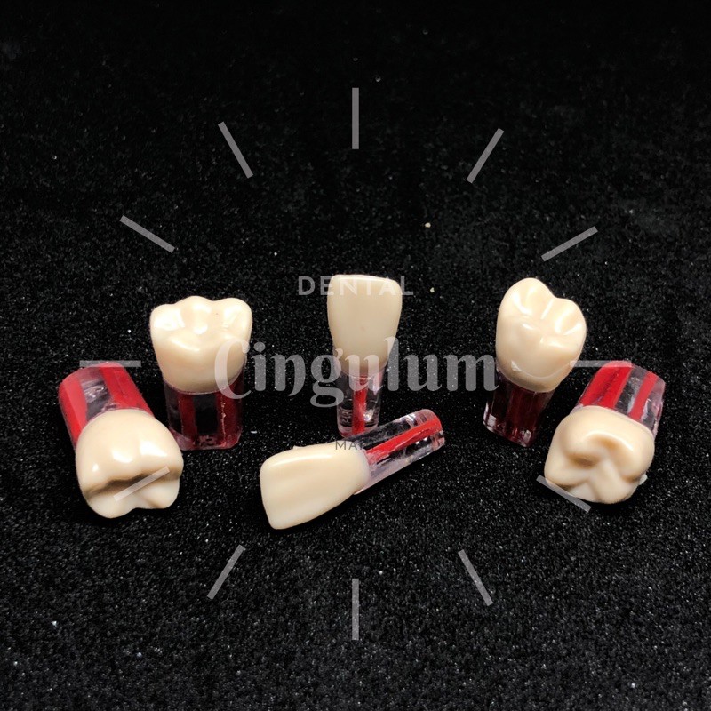 Jual Gigi Endo / Gigi Saluran Akar Lurus | Shopee Indonesia