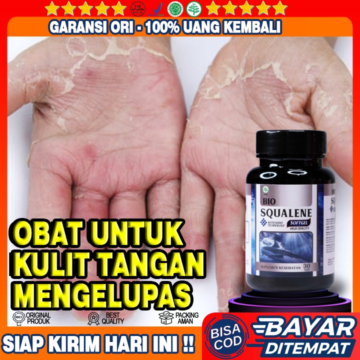 Jual Obat Kulit Jari Mengelupas - Obat Telapak Tangan Kasar - Obat Jari ...