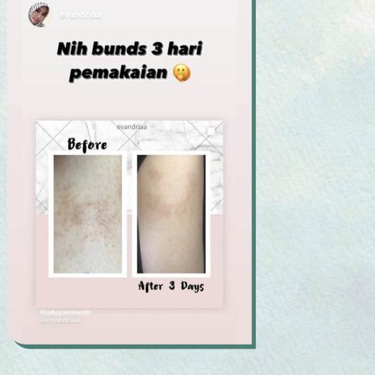 Jual Calming Balm (Eczema & Rash Cream) 30 ml Cahaya Naturals | Shopee ...