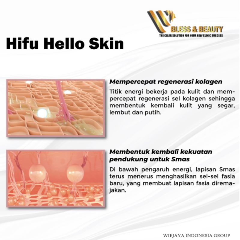 Jual Alat Perawatan Wajah Hifu Hello Skin Mengencangkan Kulit V Shape ...