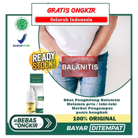 Jual Obat Penghilang Balanitis Kelamin pria / laki-laki | Herbal Pengempes penis bengkak, Salep ...