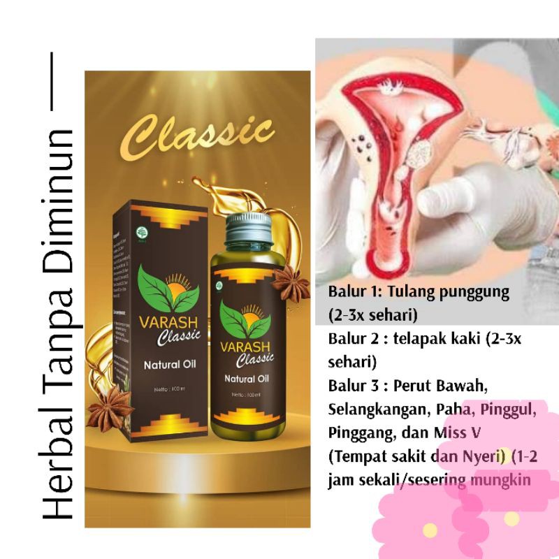 Jual MINYAK VARASH CLASSIC BOOSTER OBAT BENJOLAN, KISTA, AMBEIEN, STROKE - Untuk semua penyakit ...