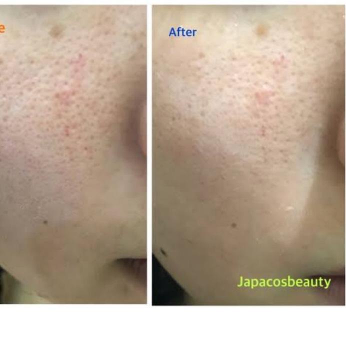 Jual Laris|LR34|[ NEW STOCK ] NADESHIKO KEANA RICE MASK 10 SHEET JAPAN ...