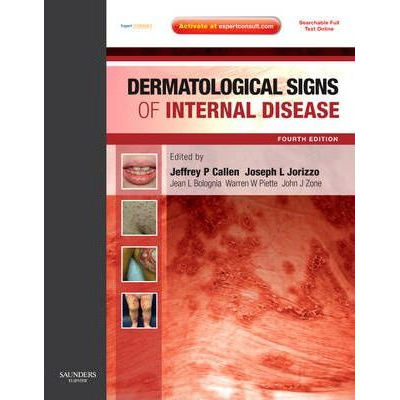 Jual Dermatological Signs Of Internal Disease 4Ed | Shopee Indonesia