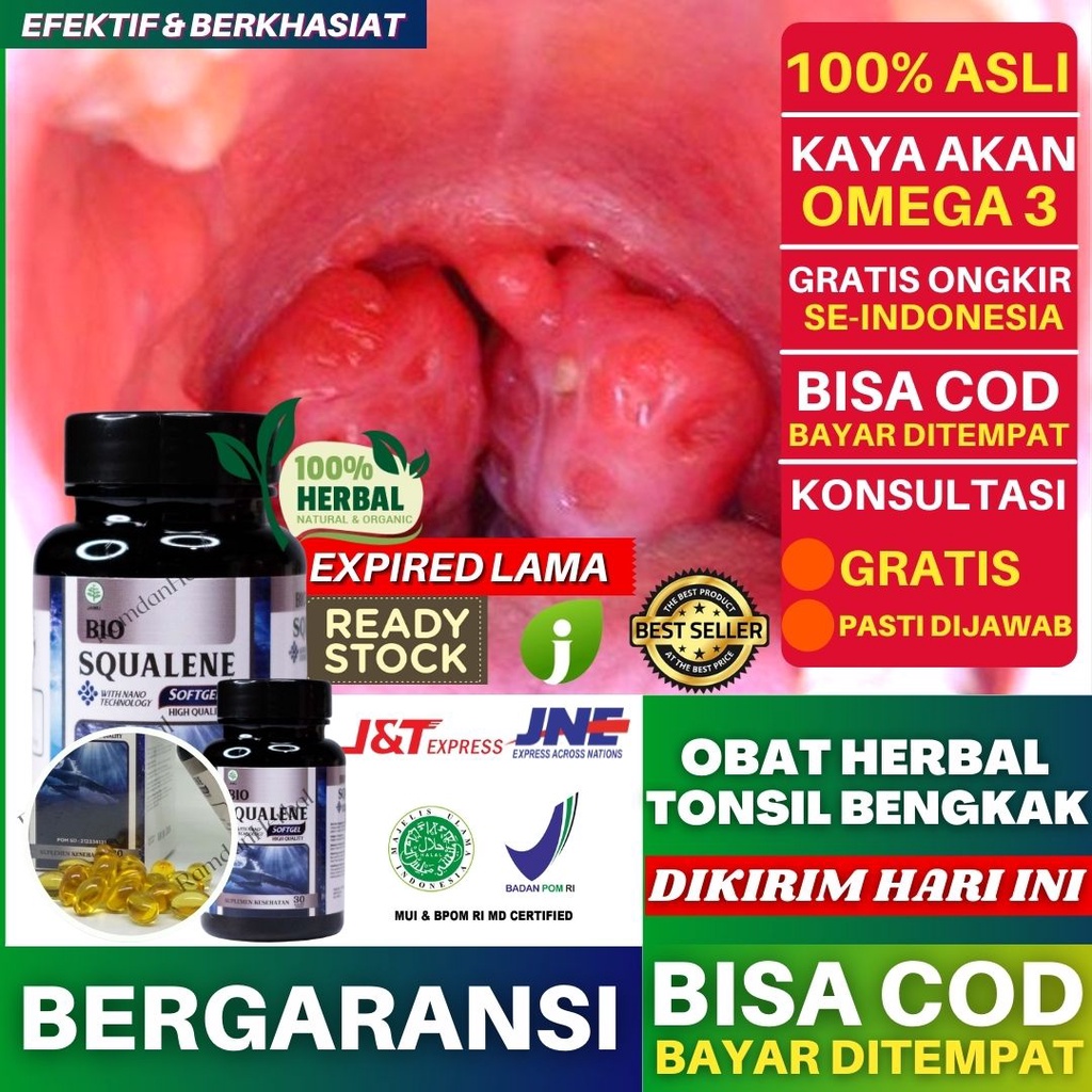 Jual Obat Tonsil Bengkak Obat Tonsillitis Obat Amandel Nyeri ...