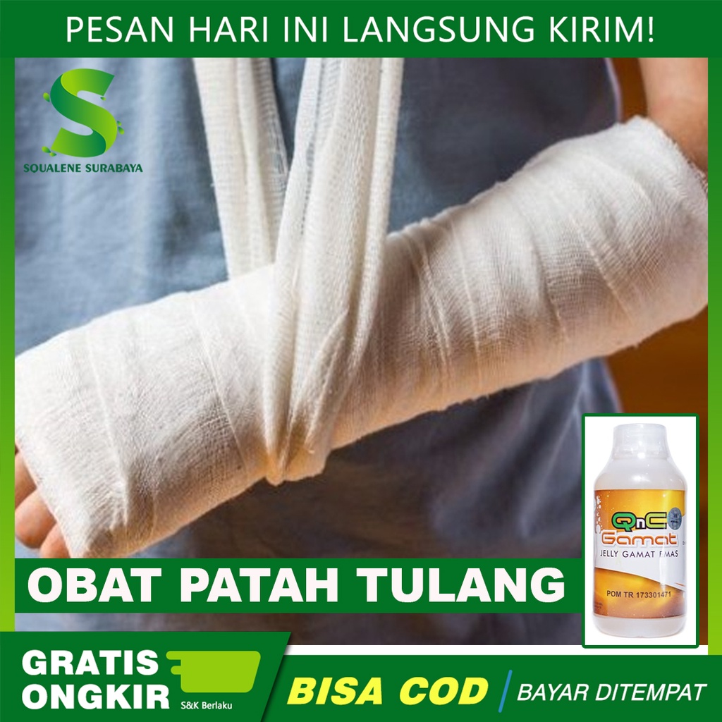 Jual Obat Patah Tulang - Patah Tulang Akibat Jatuh Kecelakaan - Tulang ...