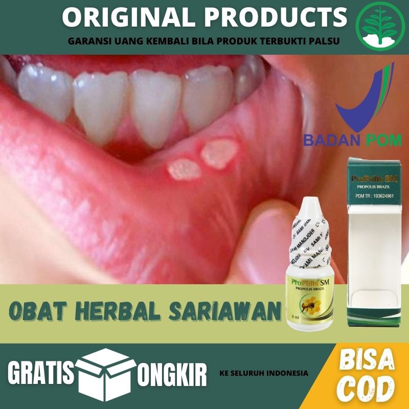 Jual Obat Sariawan Menahun Obat Sariawan Di Gusi Obat Sariawan Di Lidah Obat Sariawan Di