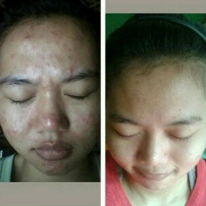 Jual Chitin Chitosan Tiens Citin Citosan Tianshi Chitin Chitosan ...